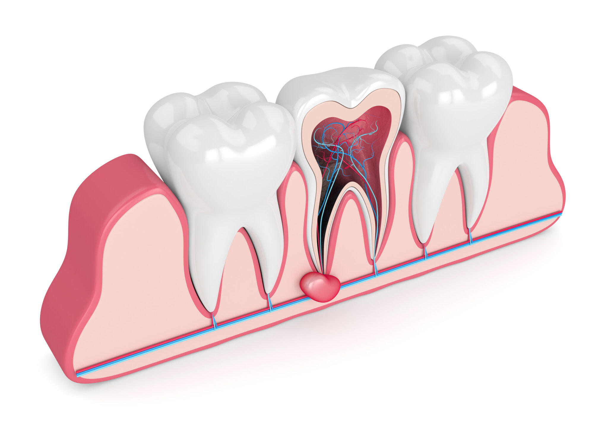 How A Tooth Extraction Helps Smiles | Newport Beach, CA